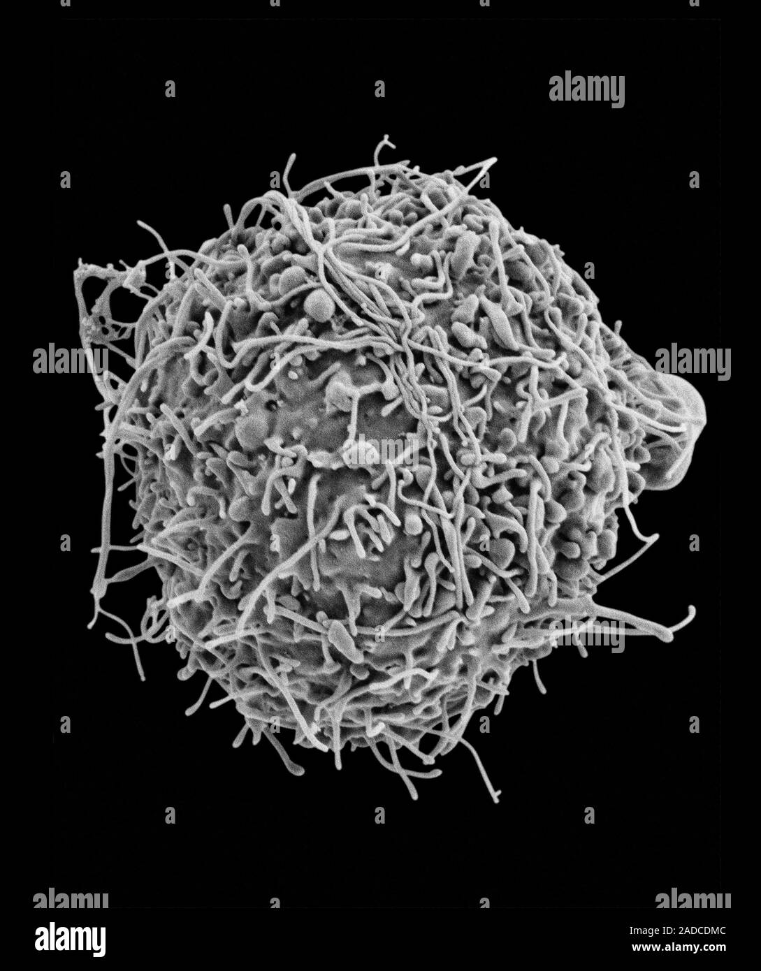 Cellule di ovaia di criceto cinese (CHO), cellule micrografia al ...