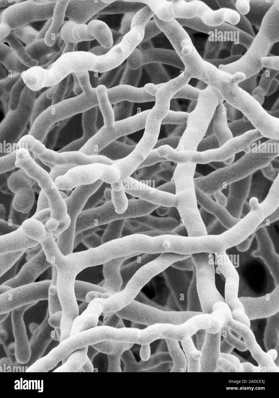 Micrografia al microscopio elettronico a scansione (SEM) di Streptomyces mashuensis, Gram ...