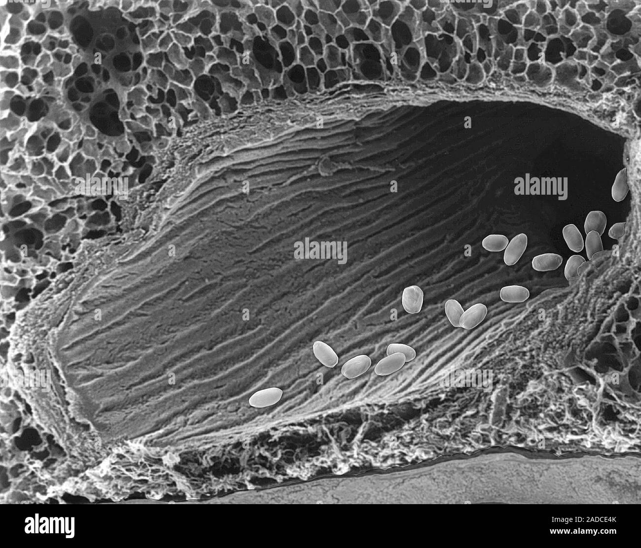 Micrografia al microscopio elettronico a scansione (SEM) di ...