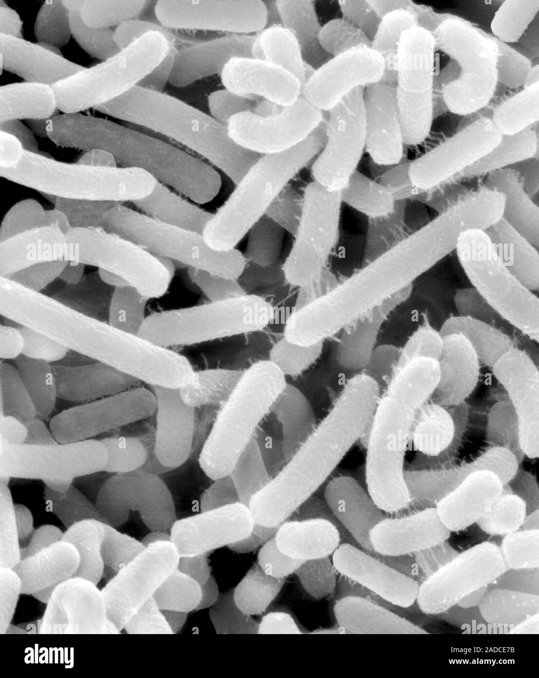 Micrografia al microscopio elettronico a scansione (SEM) di ...