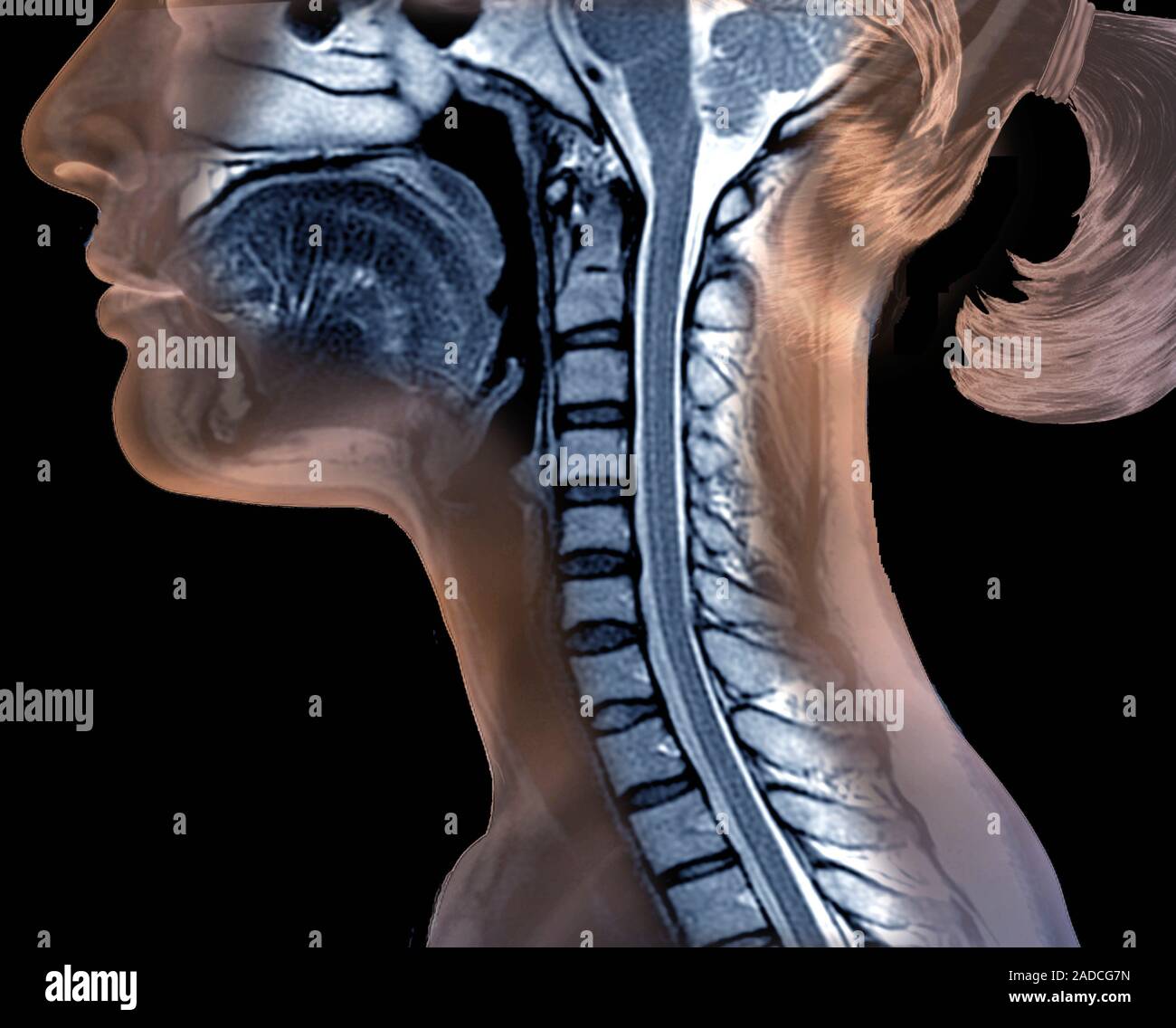 La colonna vertebrale cervicale e del tronco cerebrale. Sagittale ...