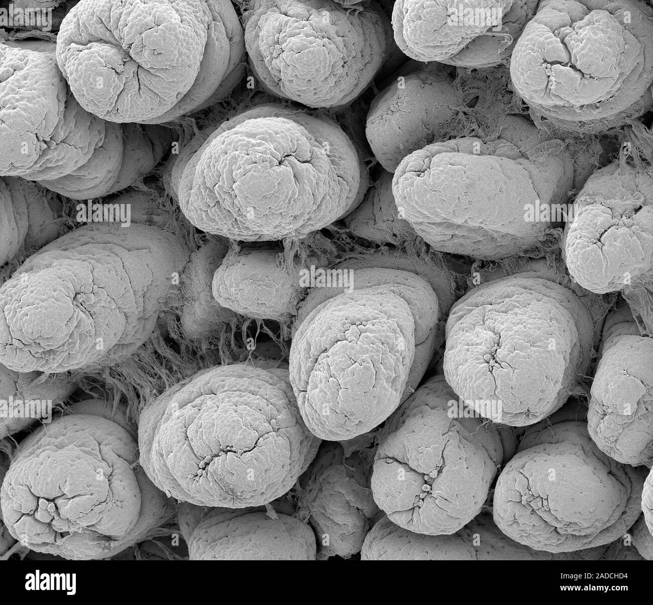 Villi intestinali. Micrografia al microscopio elettronico a scansione ...