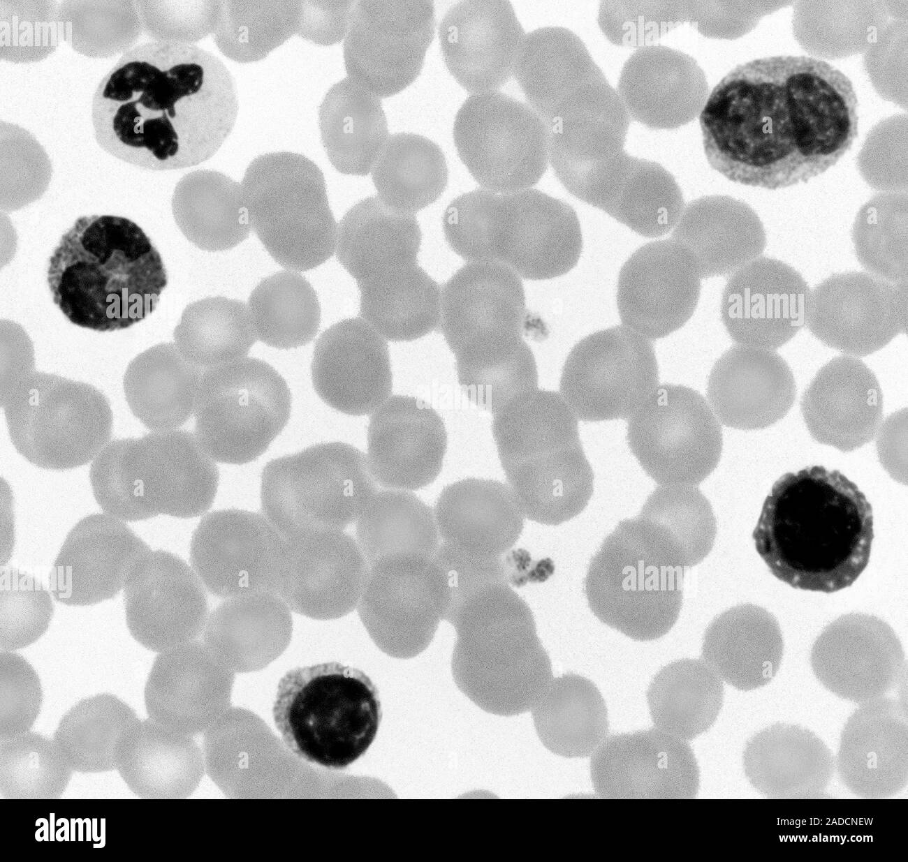 Micrografia di luce di un normale sangue umano cospargere che mostra i ...