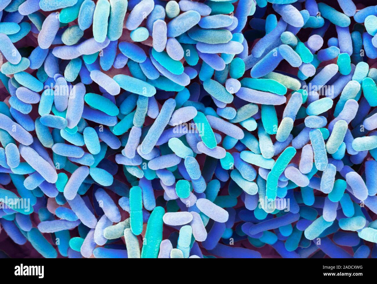 E.coli batteri. Color scanning electron microfotografia dell'asta a ...