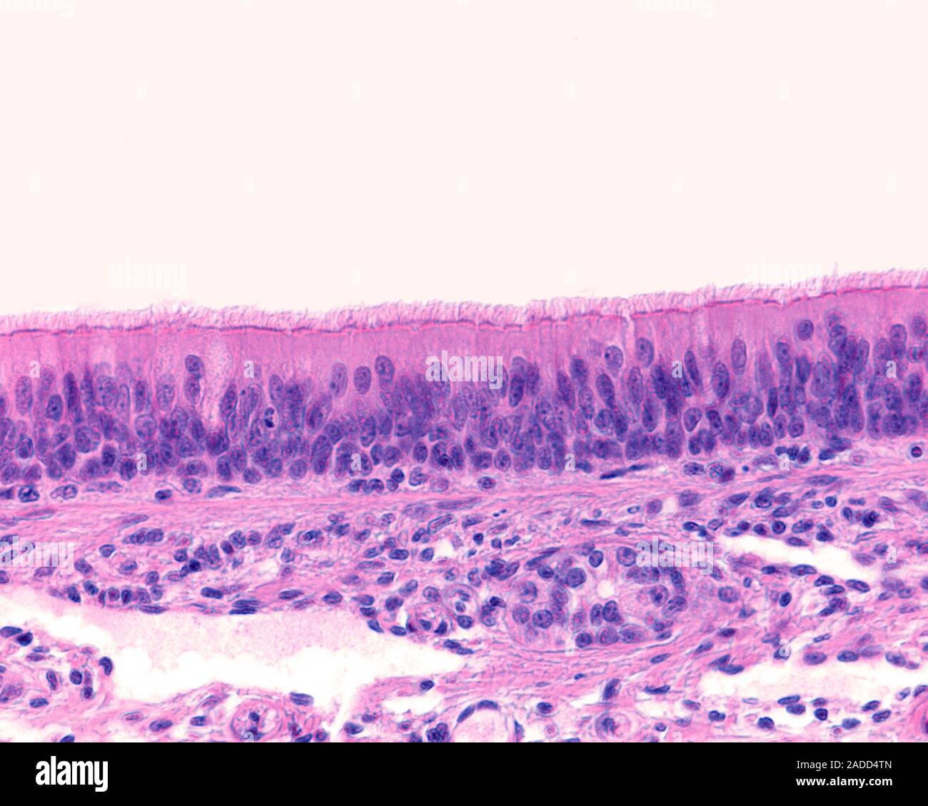Micrografia di luce di una sezione attraverso la mucosa della trachea ...
