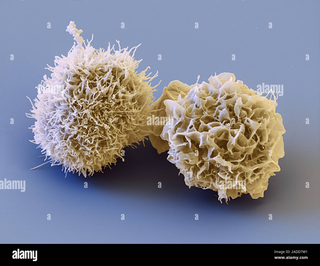 Le cellule dendritiche, colorata di microfotografia electron scansione ...