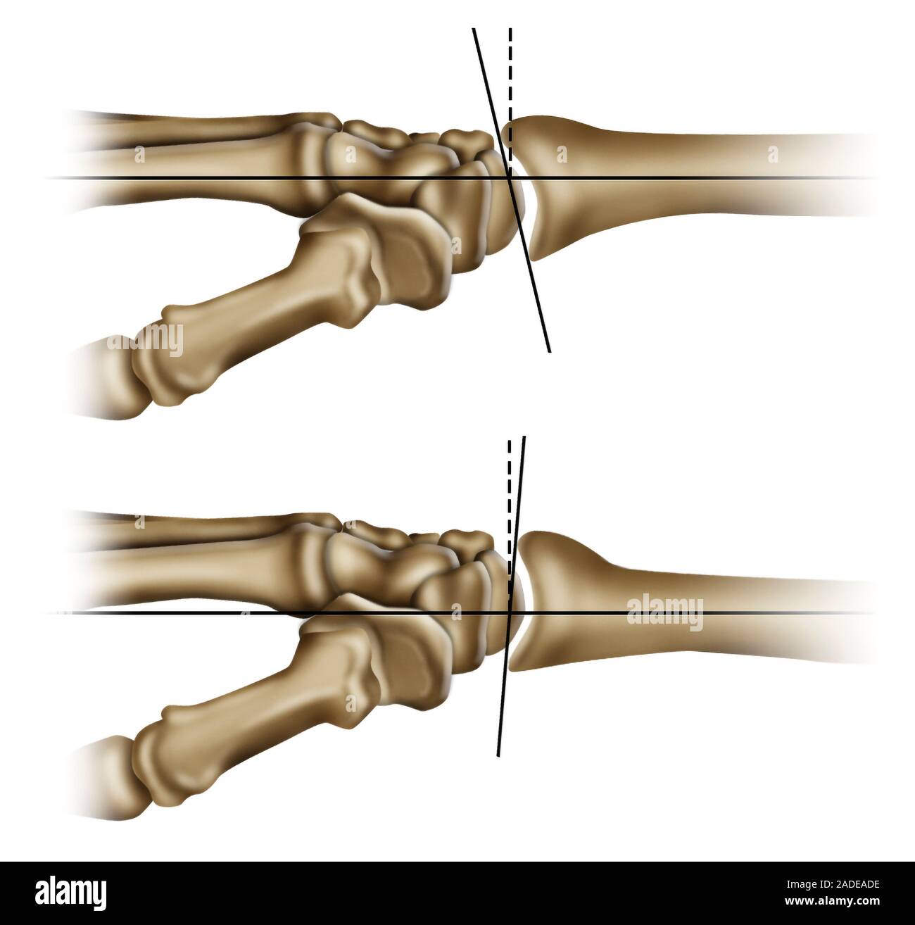 Articolazione del polso movimenti, illustrazione. Ossa dell ...