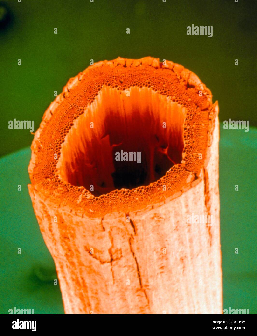 Il lino. Scanning electron microfotografia (SEM) della fibra derivata ...