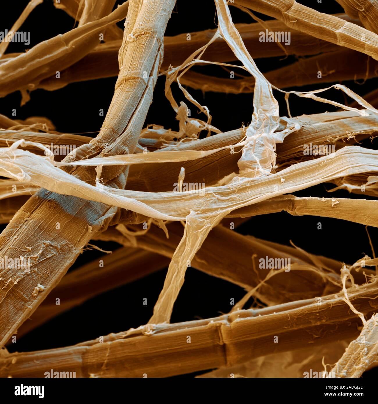 Le fibre di canapa. Color scanning electron microfotografia (SEM) di ...