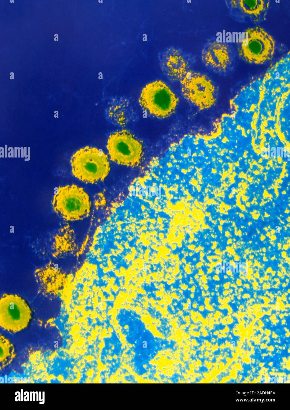 Microscopio elettronico a trasmissione di virus di herpes umano di tipo ...