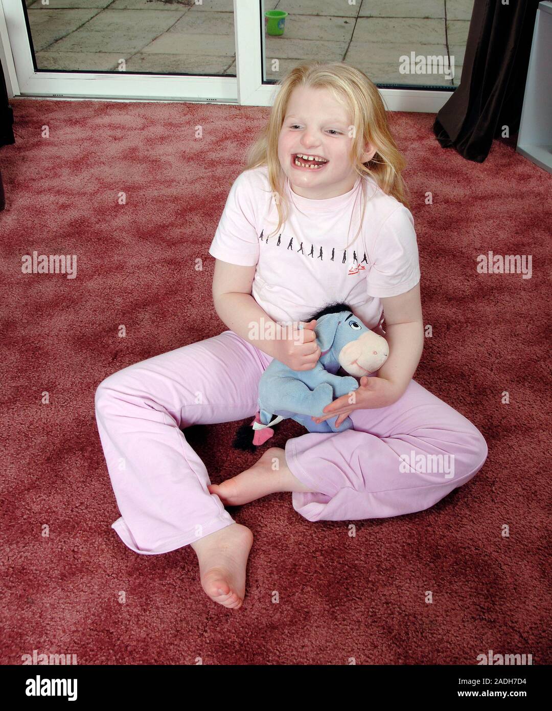 Sindrome Di Angelman