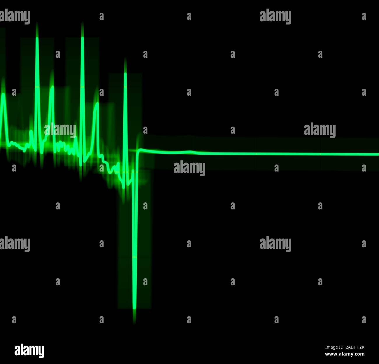 Il tracciato ECG. Computer grafica di un ECG (elettrocardiogramma ...