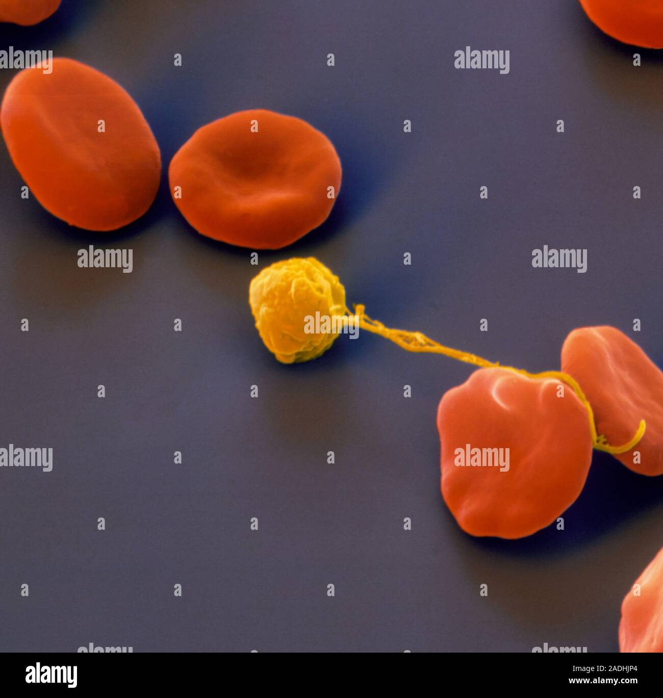 La malaria. Color scanning electron microfotografia (SEM) di Plasmodium ...