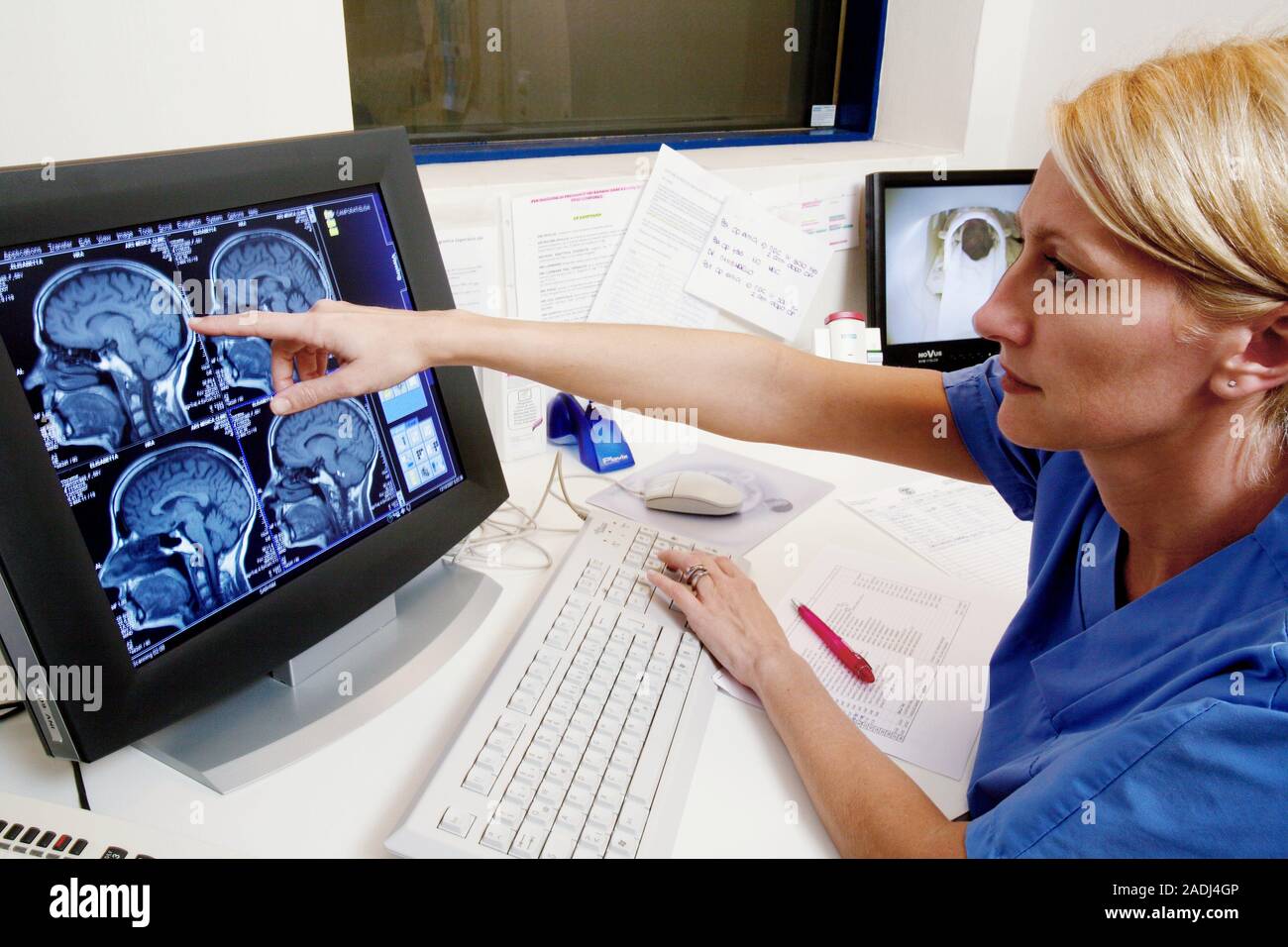 Scansione MRI. Radiologo analizzando il cervello le immagini prodotte ...