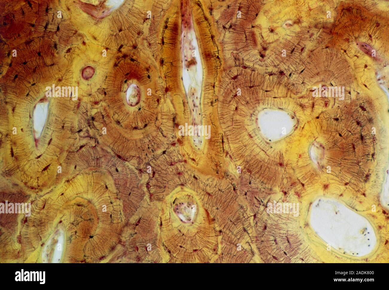 Osso compatto. Micrografia di luce di una sezione attraverso umano osso ...