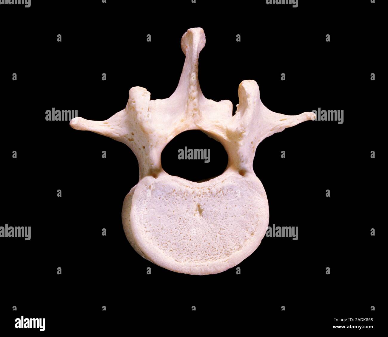 Fotografia dell'umano terza vertebra lombare (L3), uno dei cinque ossa ...