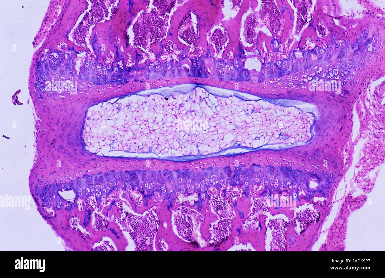 Il disco intervertebrale. Micrografia luce del disco di cartilagine tra ...