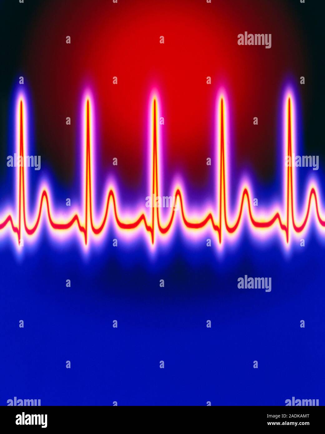 Sana cuore ECG trace. Computer-enhanced immagine di un ...