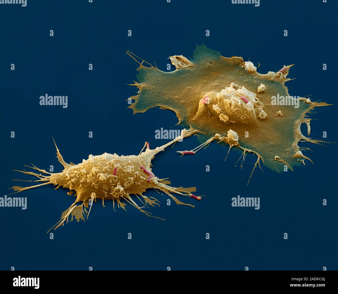 I macrofagi travolgendo E. coli. Color scanning electron ...