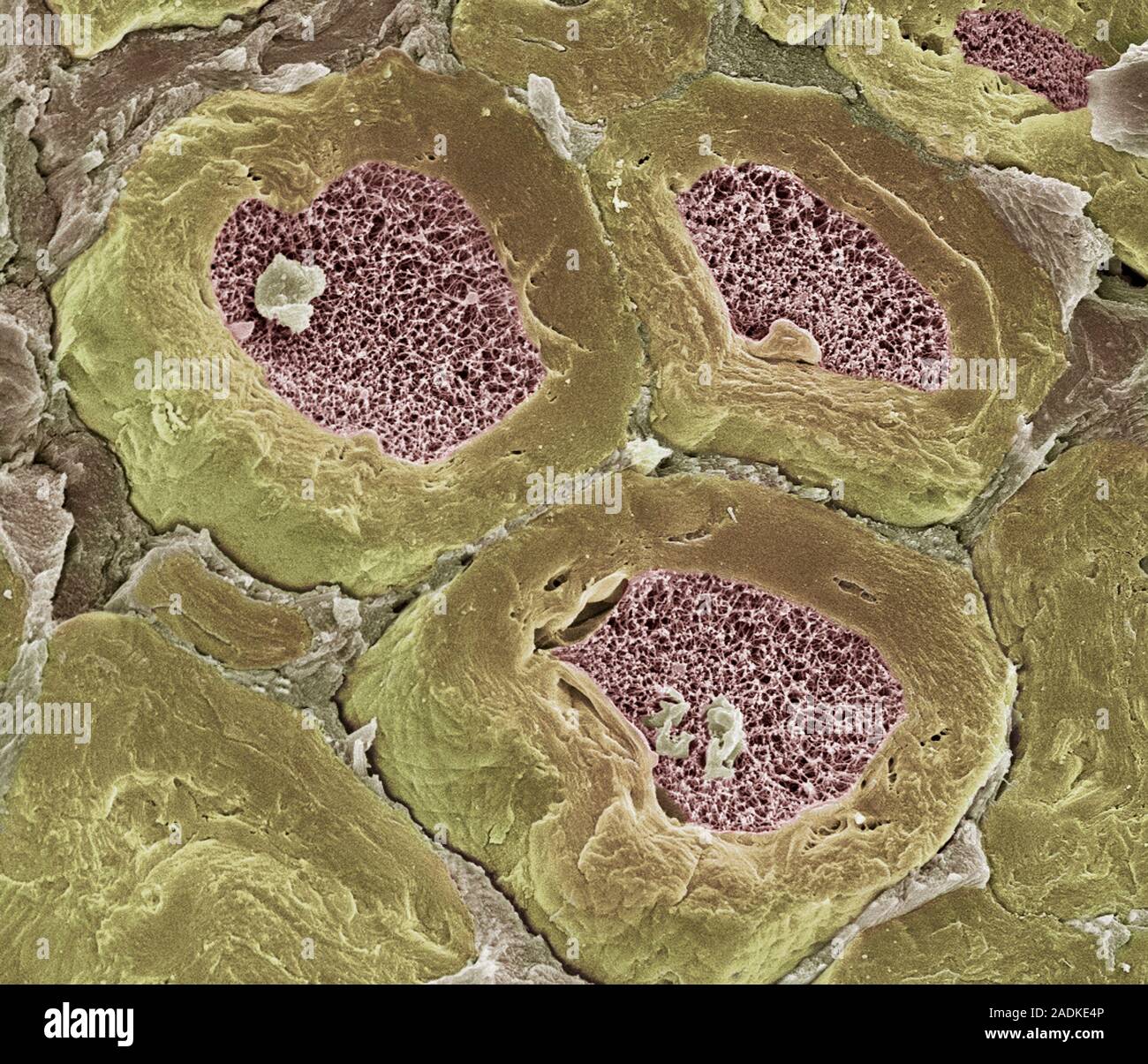 Mielinizzate nervi. Color scanning electron microfotografia (SEM) di ...