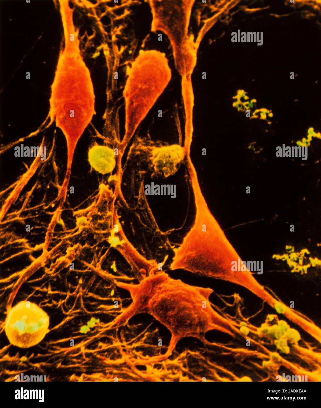 Le cellule nervose. Color scanning electron microfotografia (SEM) di ...
