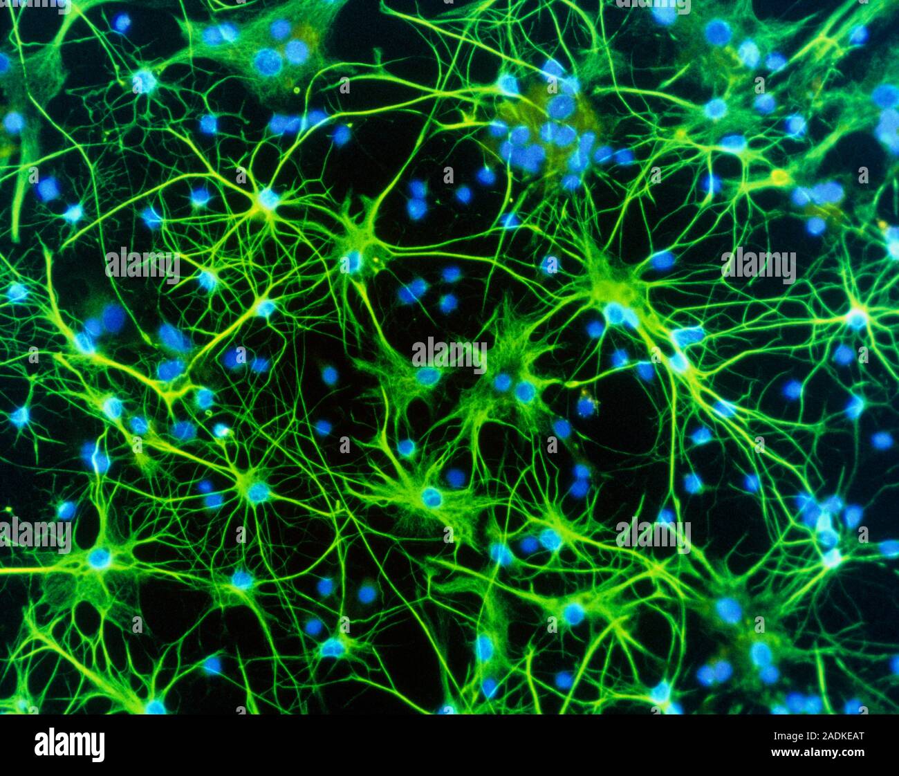 Astrocita cellule cerebrali. Luce di immunofluorescenza micrografia di ...