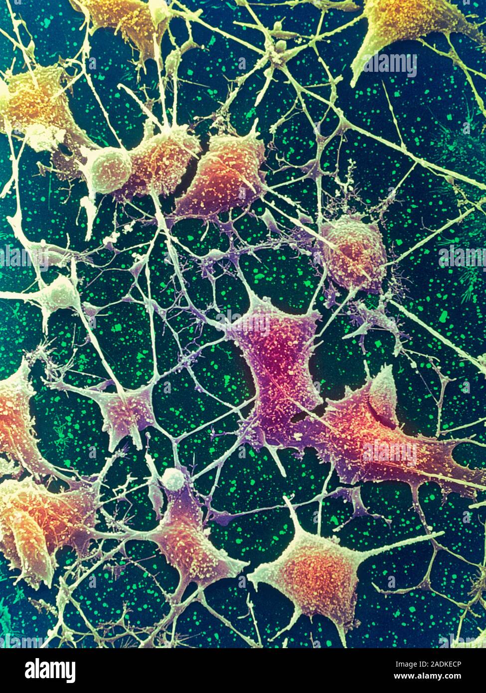 Le cellule nervose. Color scanning electron microfotografia (SEM) di ...