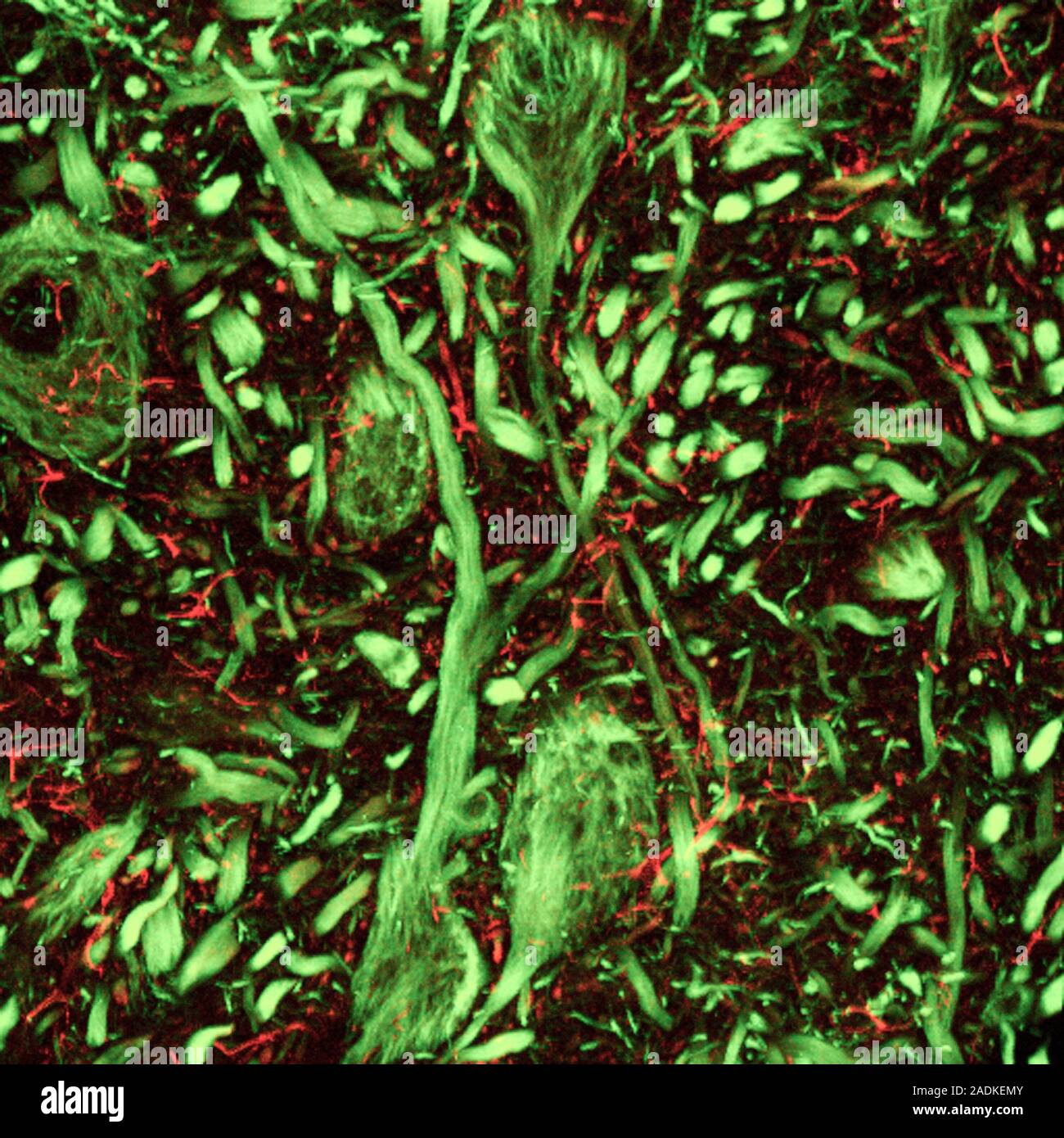 Tronco cerebrale le cellule nervose. Luce confocale micrografia di ...