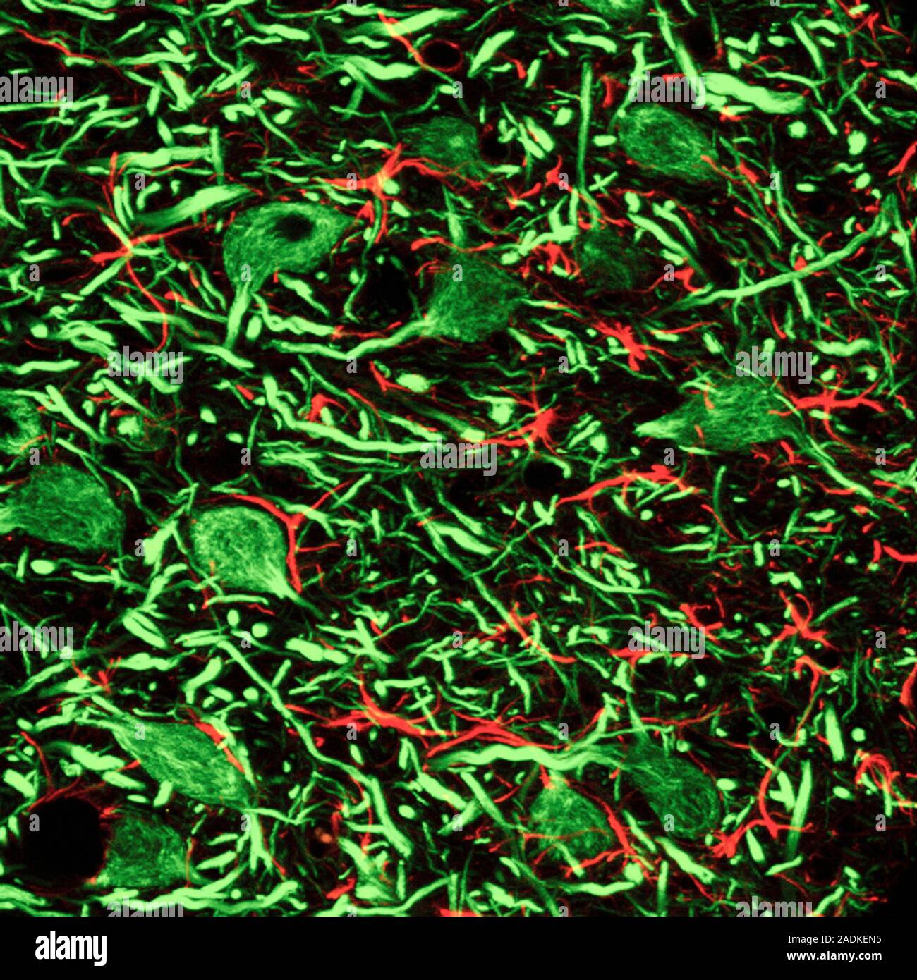 Il talamo di cellule nervose. Luce confocale micrografia di neuroni ...