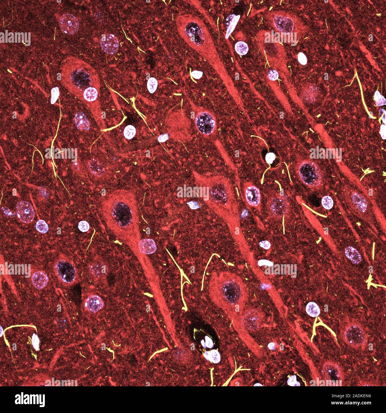 La corteccia cerebrale di cellule nervose. Luce confocale micrografia ...