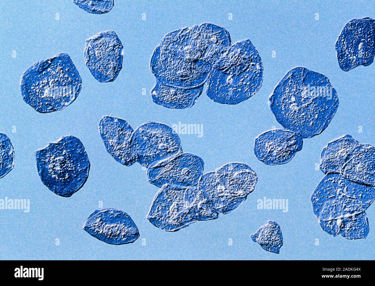 Guancia di cellule. Computer-enhanced micrografia luce di cellule ...