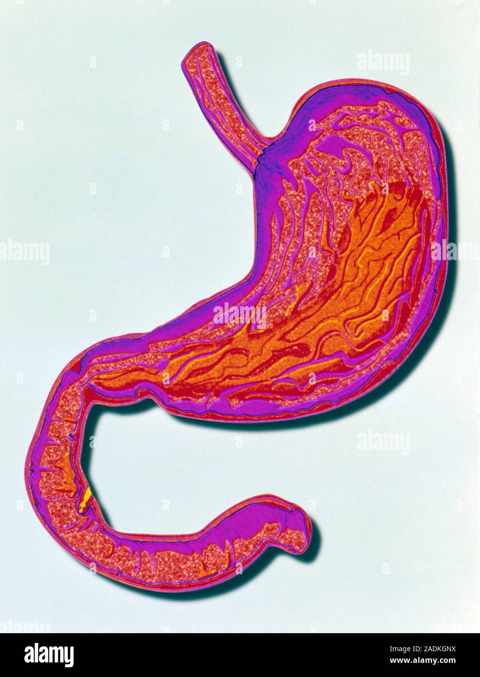 Lo stomaco. Computer artwork dello stomaco umano. Lo stomaco è una ...