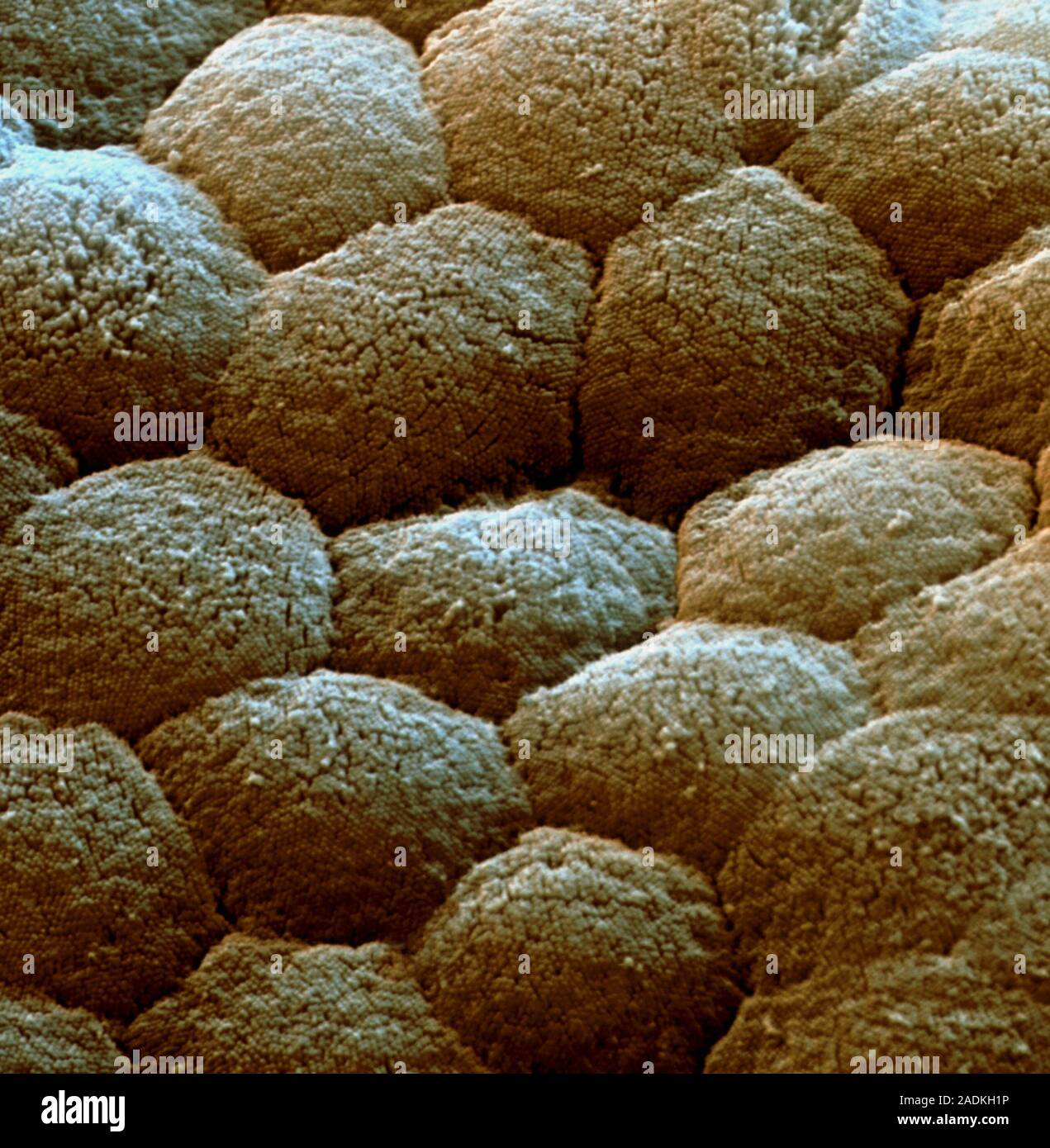 Il piccolo intestino fodera. Color scanning electron microfotografia ...