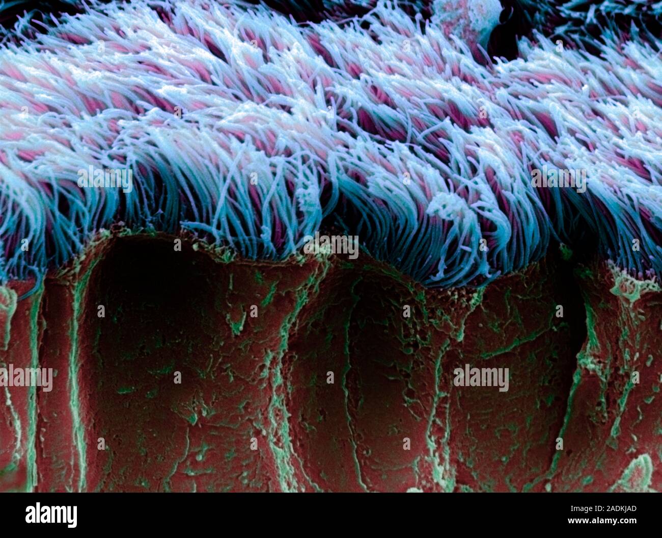 Asma bronchiale ciglia. Color scanning electron microfotografia (SEM ...