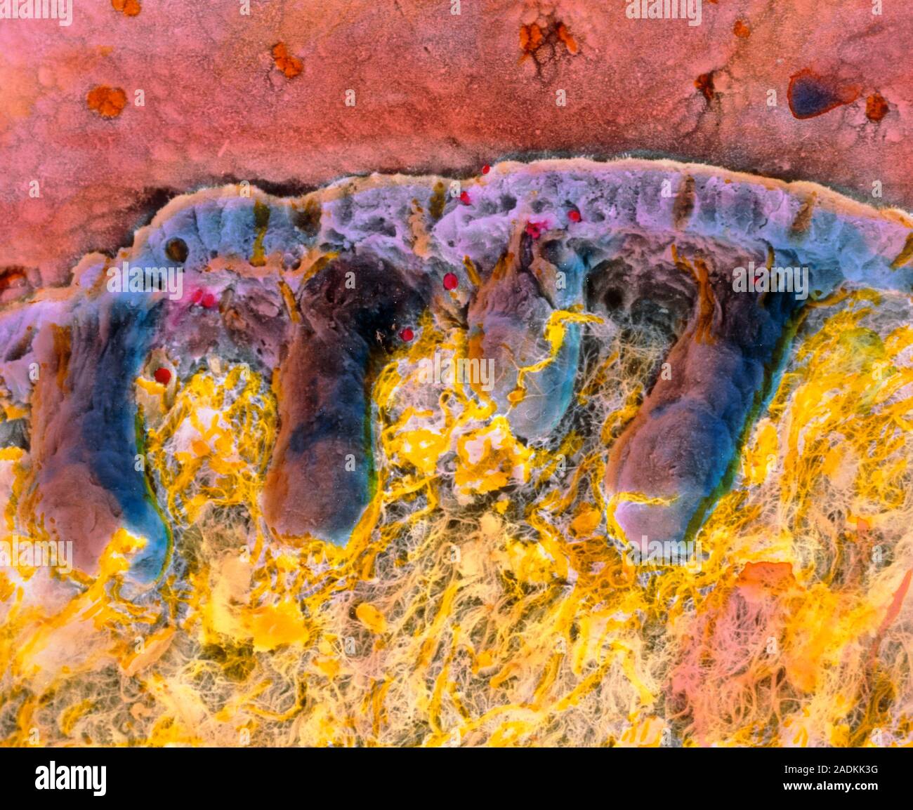 Utero endometrio. Color scanning electron microfotografia (SEM) di una ...