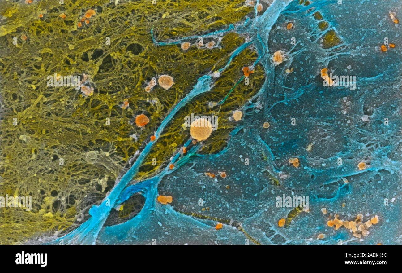 Tubo di Falloppio. Color scanning electron micro- grafico (SEM) del ...