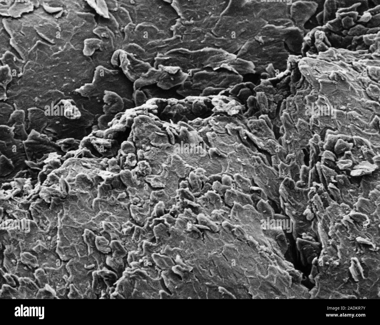 Scanning electron microfotografia (SEM) della sovrapposizione, cellule ...
