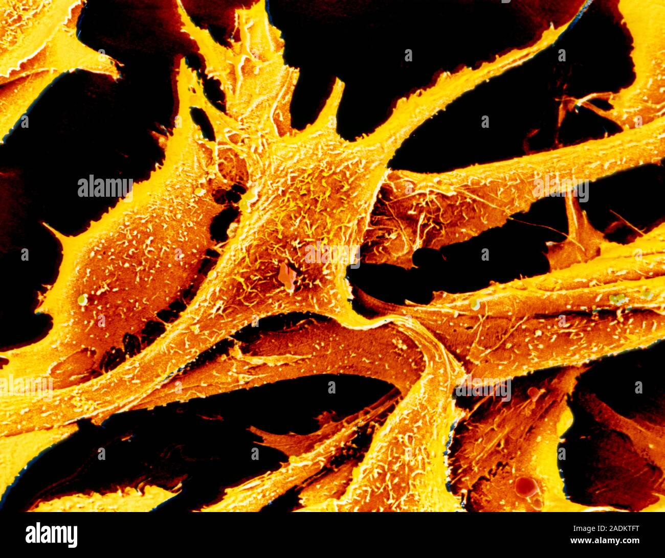 Cellule di fibroblasti. Color scanning electron microfotografia di ...