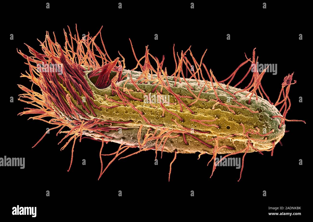 Acqua dolce protozoo ciliato. Micrografia al microscopio elettronico a ...