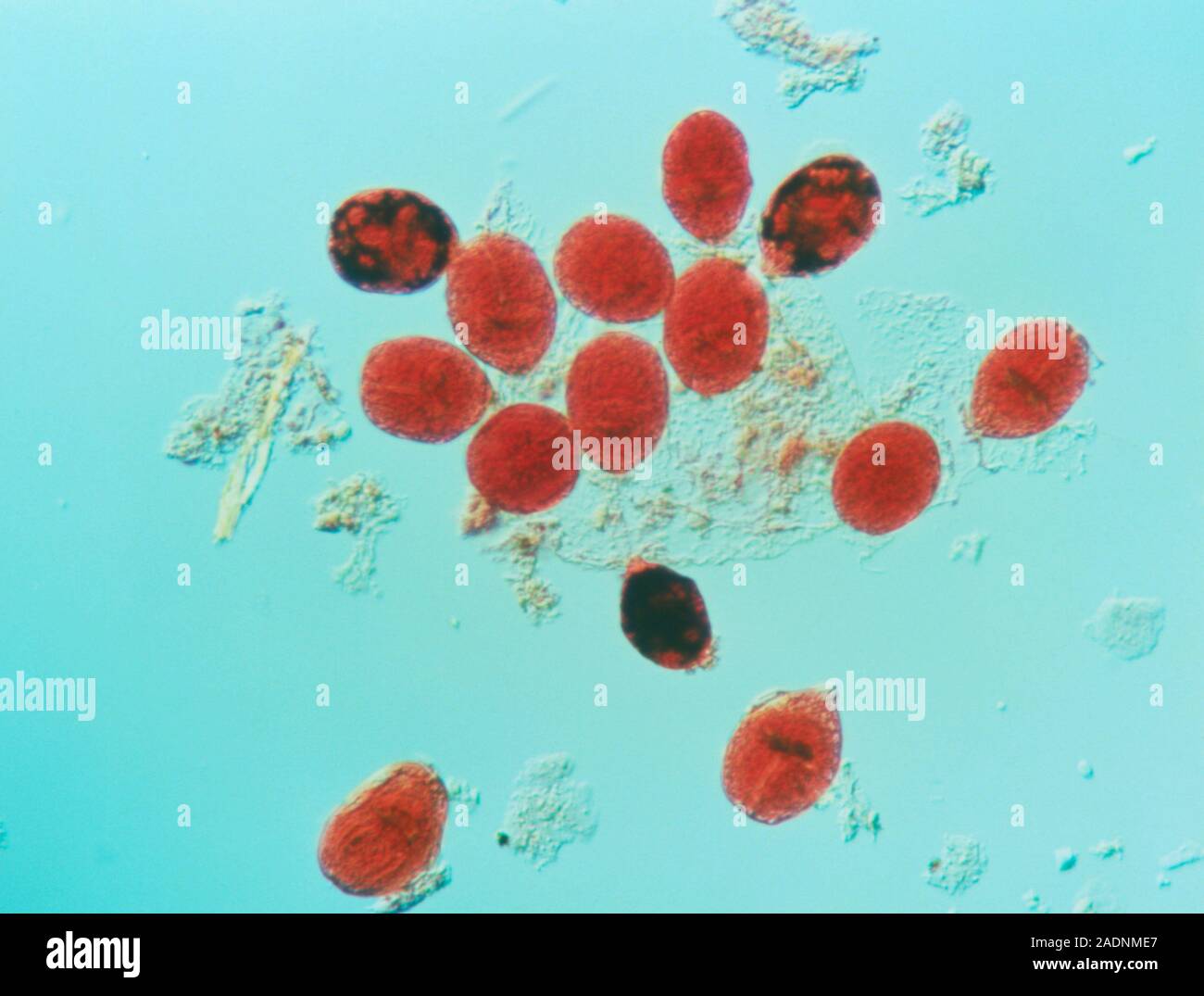 La tenia del cane. Micrografia di luce di un gruppo di cysticerci dal ...