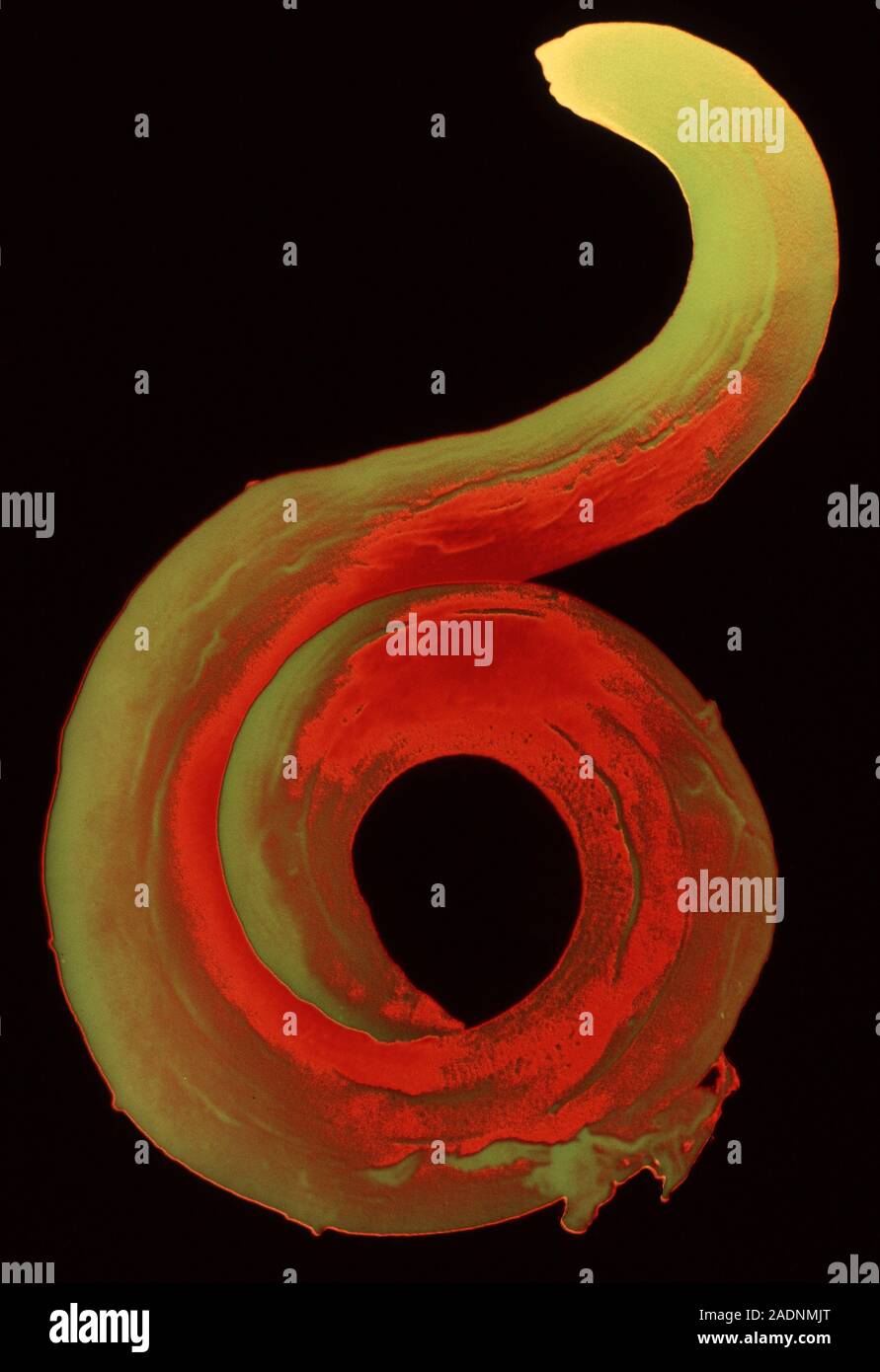 Toxocara canis. Color scanning electron microfotografia del nematode ...