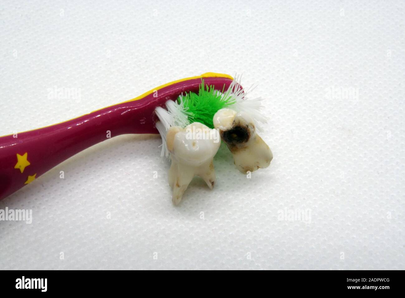Cattivo denti e uno spazzolino. Igiene dentale. Dente marcio e uno ...