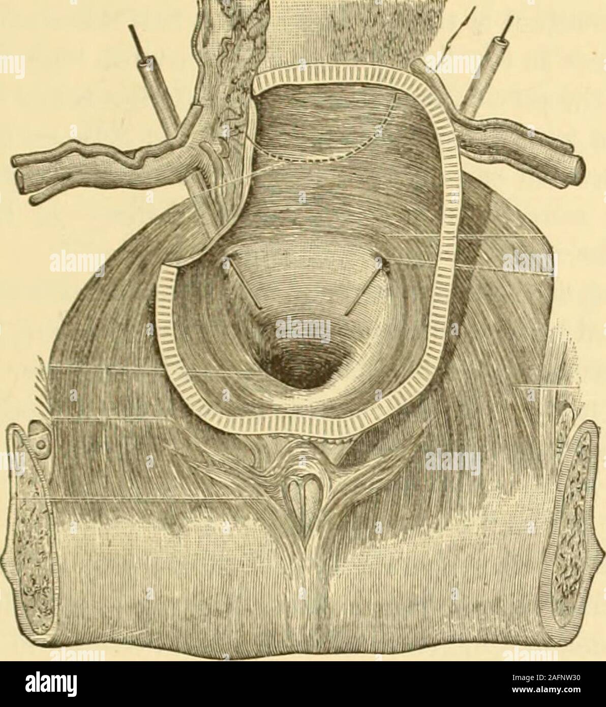 Arteria iliaca comune immagini e fotografie stock ad alta risoluzione ...