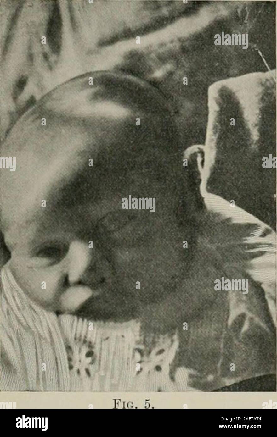 Spina ischiatica immagini e fotografie stock ad alta risoluzione - Alamy