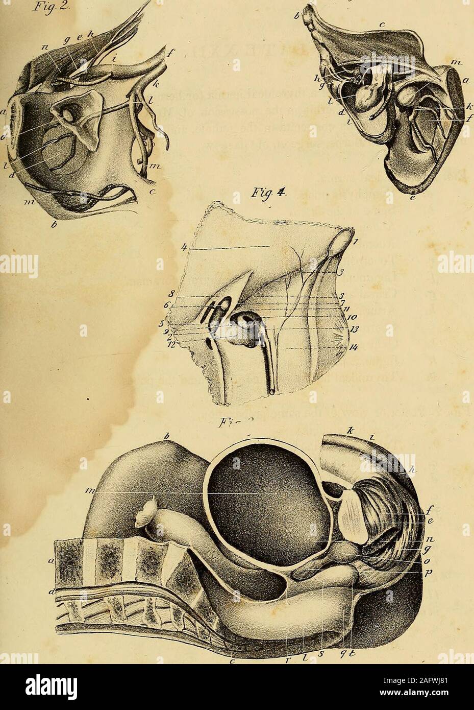 . L'anatomia e il trattamento chirurgico di ernia addominale. valis ...