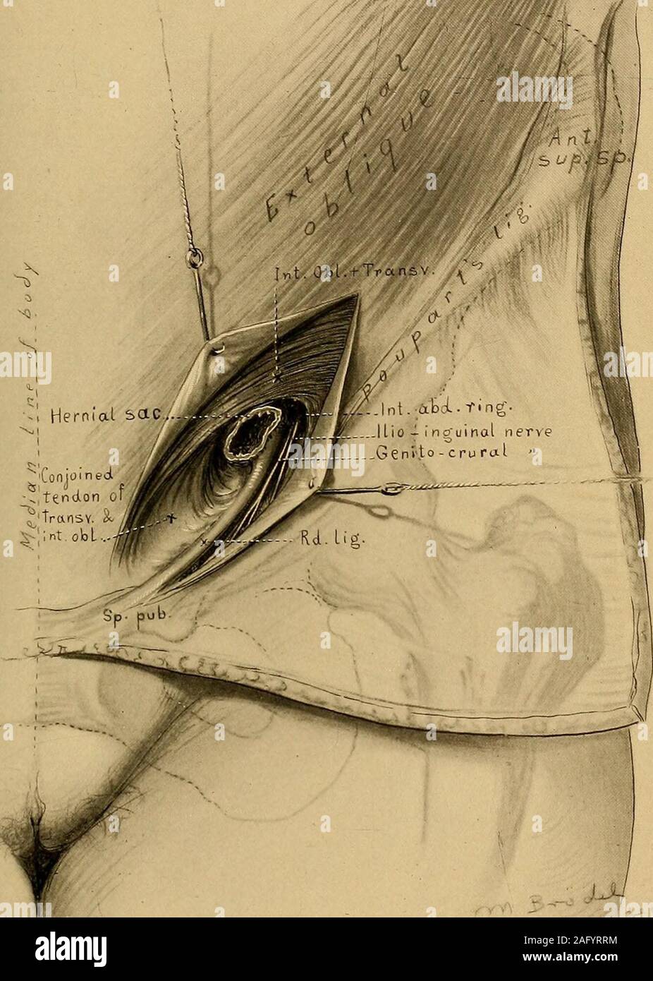 Canale inguinale immagini e fotografie stock ad alta risoluzione ...