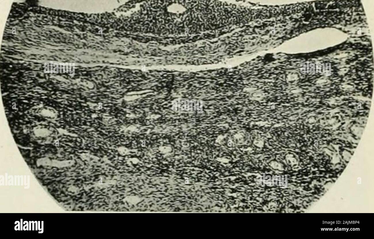 Cellule di granulosa immagini e fotografie stock ad alta risoluzione ...