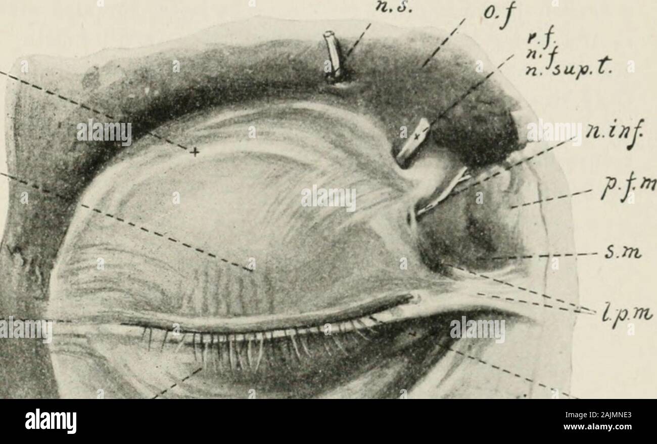 Neurite retrobulbare immagini e fotografie stock ad alta risoluzione ...