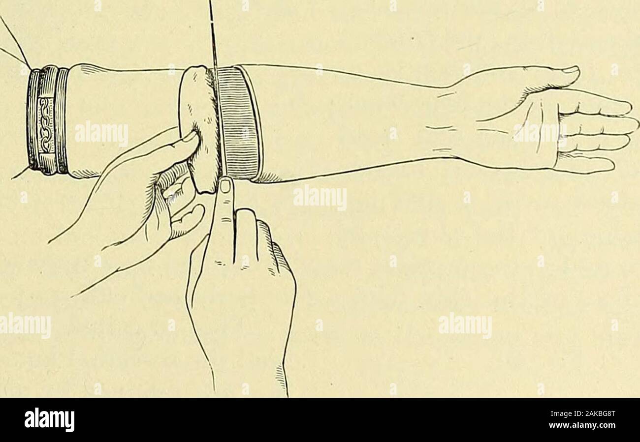 Un manuale per la moderna chirurgia : una esposizione delle dottrine ...