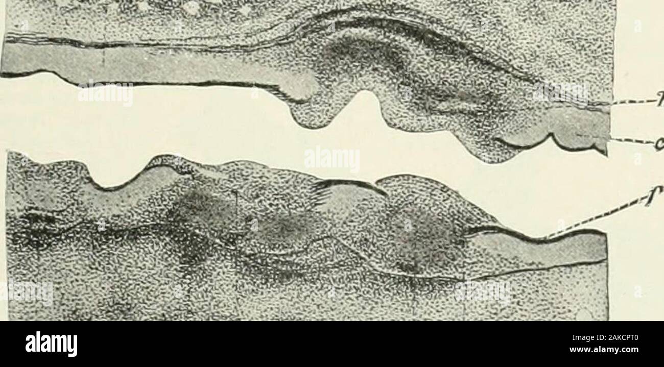 Lamina elastica esterna immagini e fotografie stock ad alta risoluzione ...